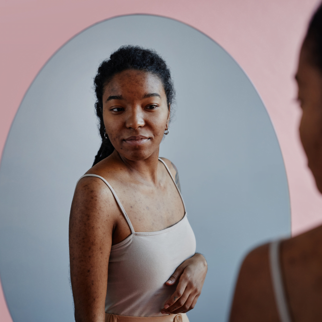 What scar removal really works? | Skin Perfection