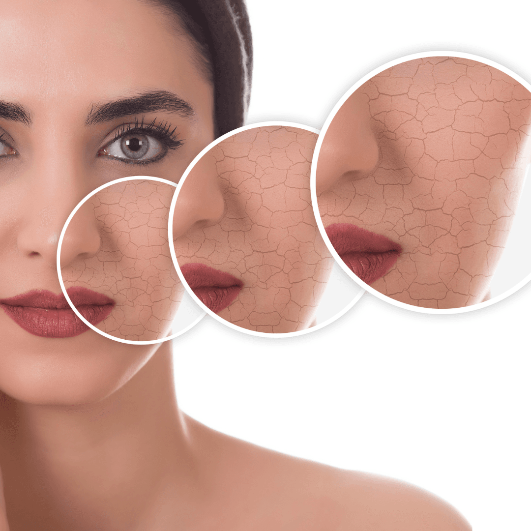 Does laser hair removal make you age faster? | Skin Perfection