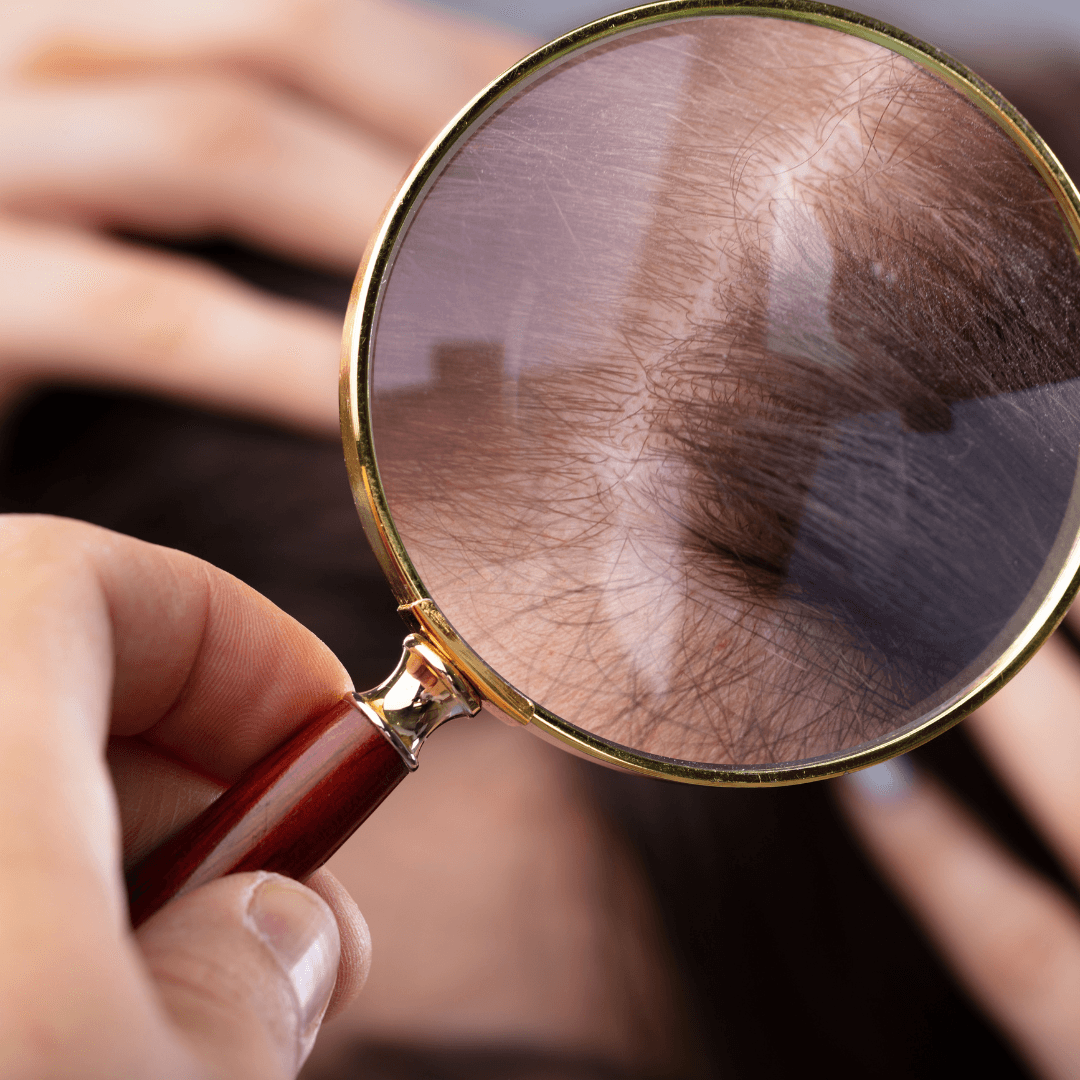 What are the main causes of hair loss? | Skin Perfection